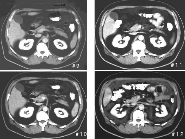 Cross Sectional Anatomy | PPT