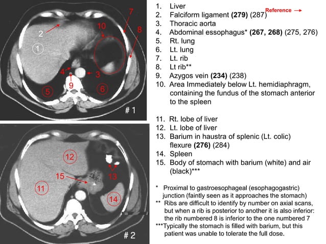 Cross Sectional Anatomy | PPT