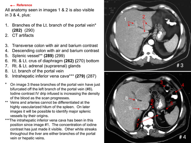 Cross Sectional Anatomy | PPT