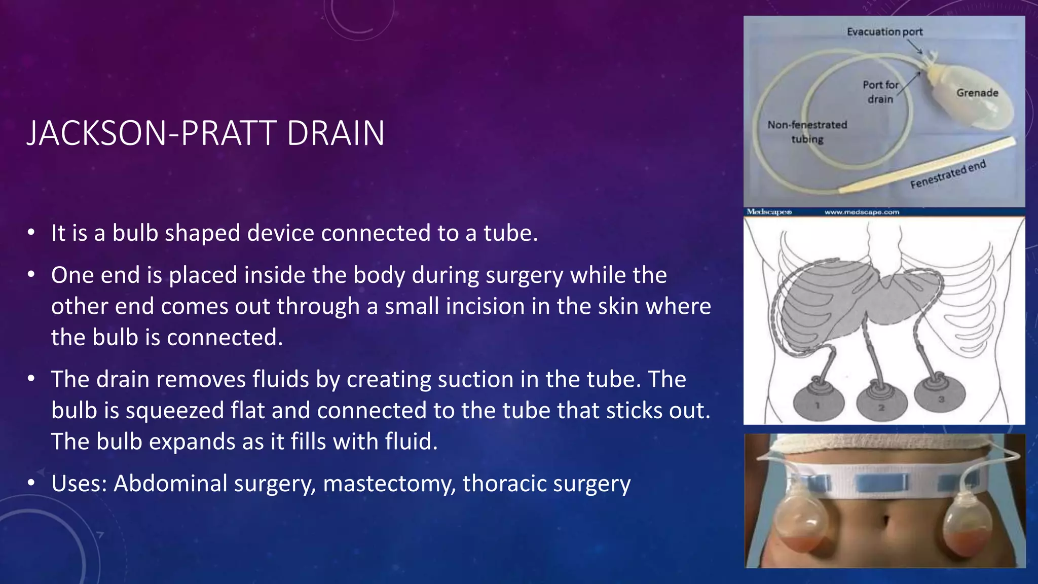 Dead space management | PPTX