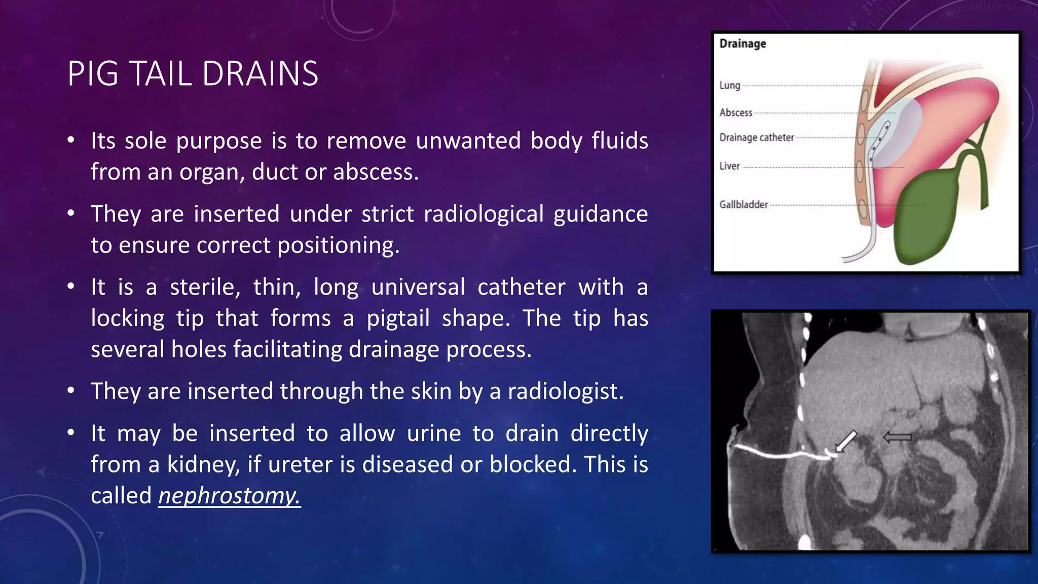 Dead space management | PPTX