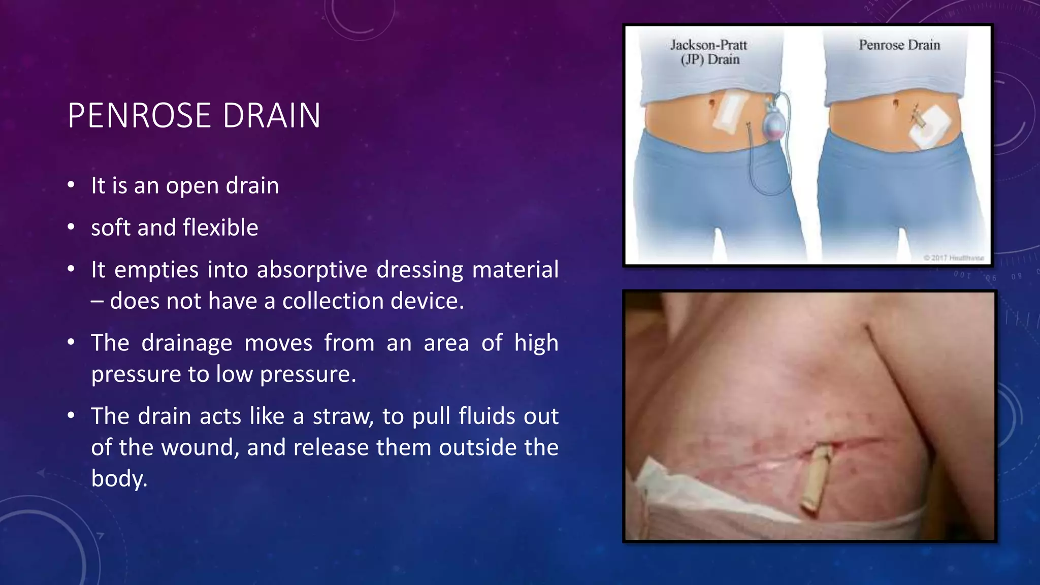 Dead space management | PPTX
