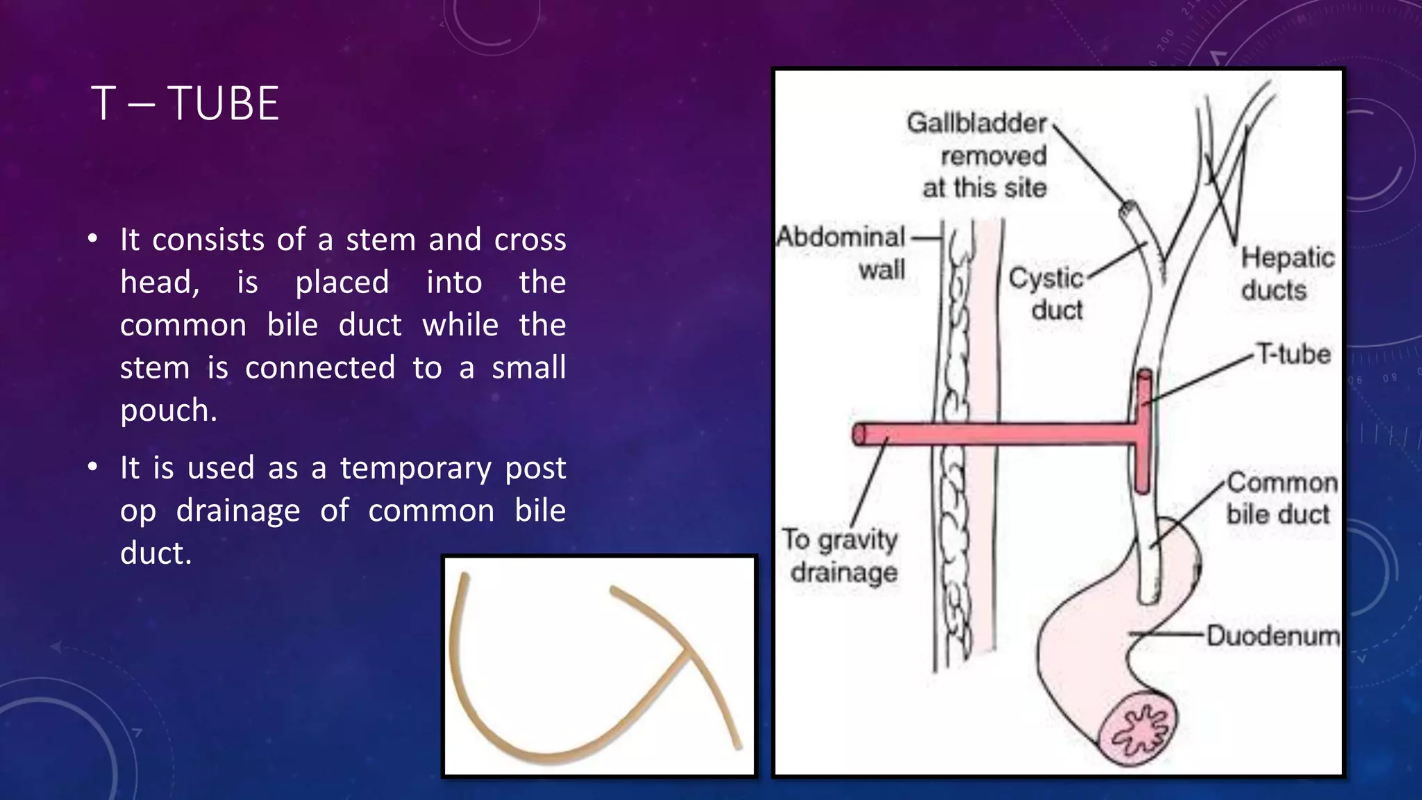 Dead space management | PPTX