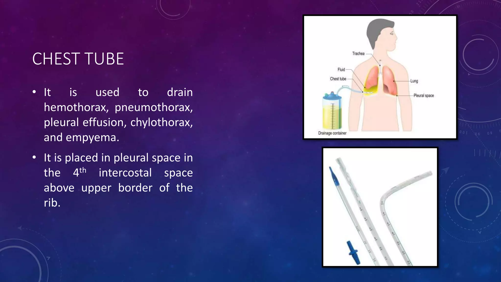 Dead space management | PPTX