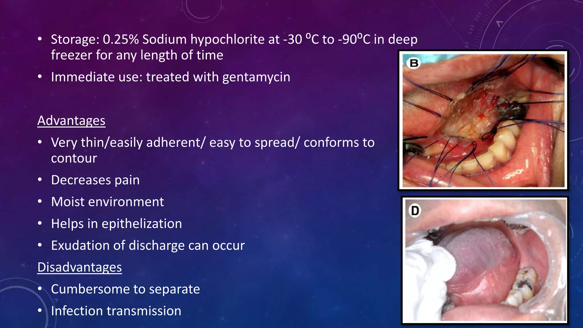 Dead space management | PPTX