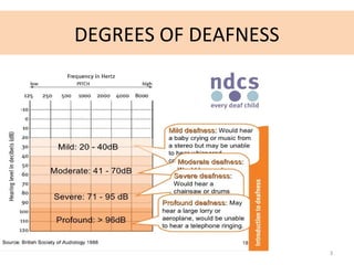 Deaf causes | PPT