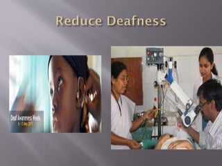 Deafness Pptx