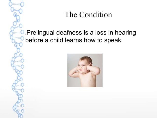 Deafness | PPT