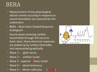 ASSESSMENT OF Deafness | PPT