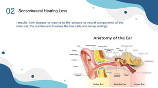 Deafness-Hearing-loss-Presentation.power | PPT