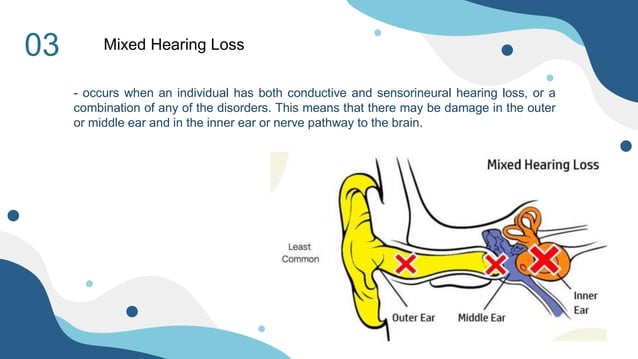 Deafness-Hearing-loss-Presentation.power | PPT