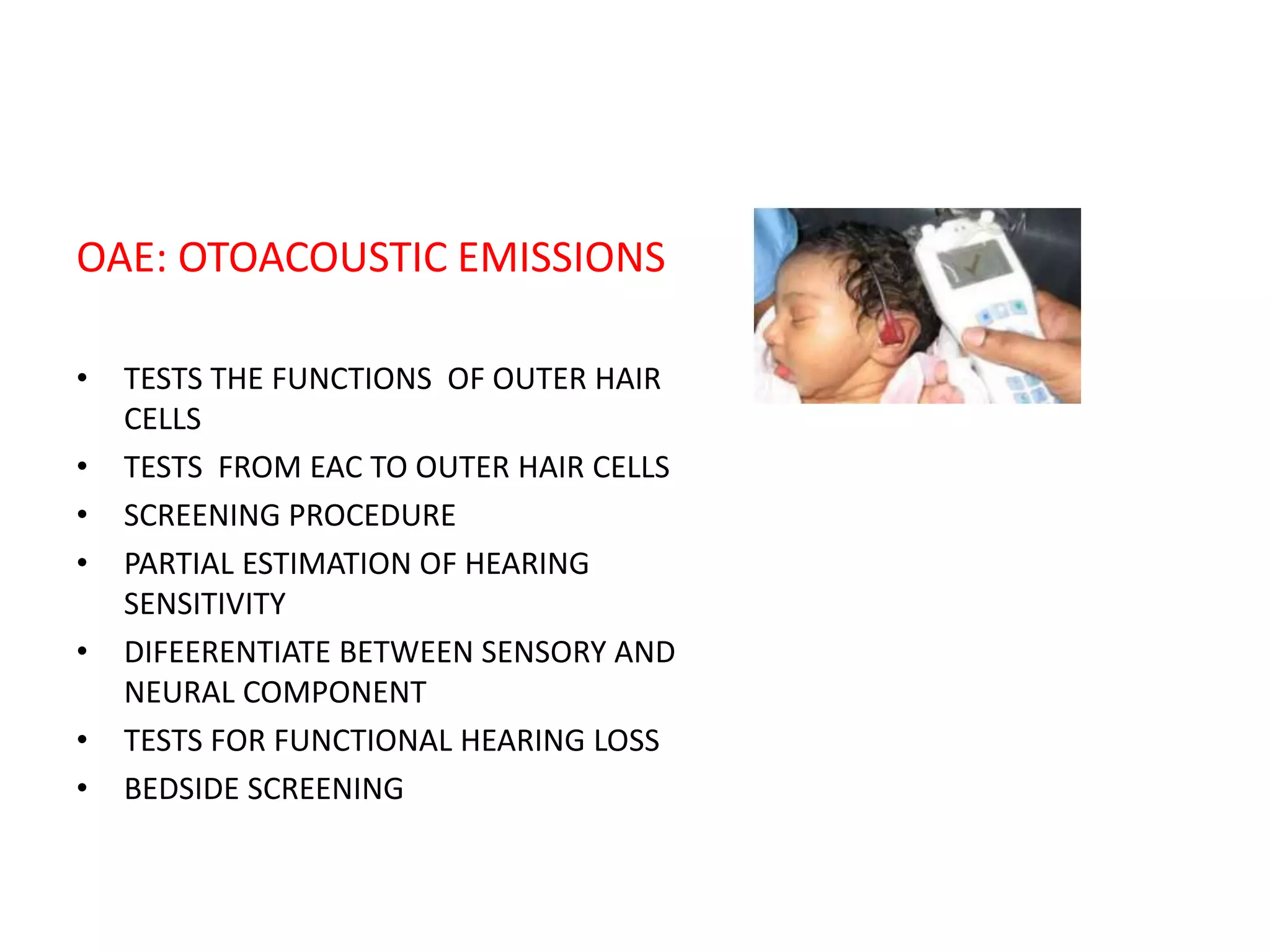 Deafness and its management | PPTX