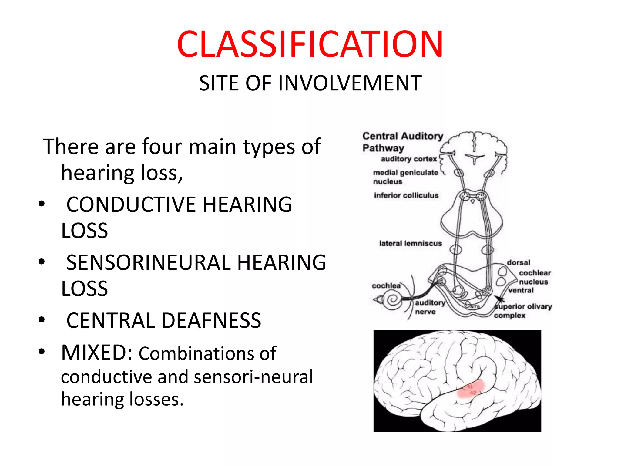 Deafness and its management | PPTX