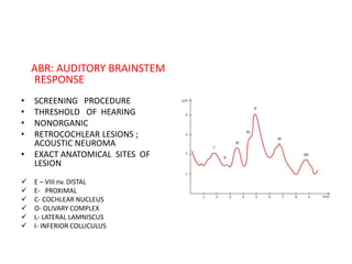 Deafness and its management | PPTX