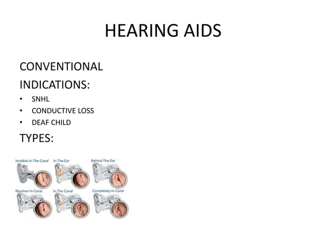 Deafness and its management | PPTX | Ear, Nose and Throat Conditions ...