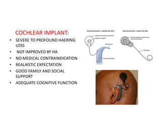 Deafness and its management | PPTX