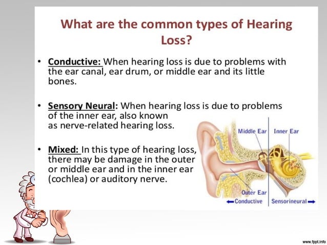 Deafness | PPT | Ear, Nose and Throat Conditions | Diseases and Conditions
