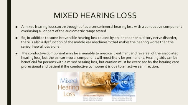 DEAFNESS/HEARING LOSS