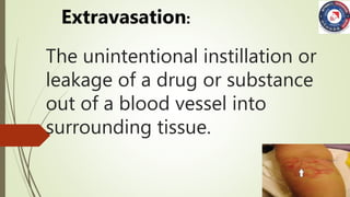Dealing with extravasation | PPTX
