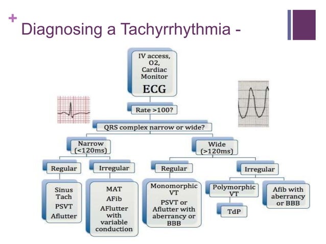 Dealing with tachycardias | PPTX | Heart and Cardiovascular Diseases ...