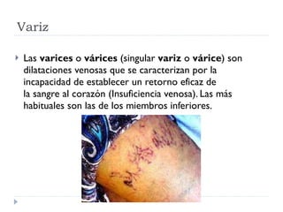Deambulacion y varices (generalizado) | PPS