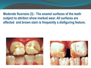 Deans F index and who o h a form - dr. Vaibhav (2).pptx