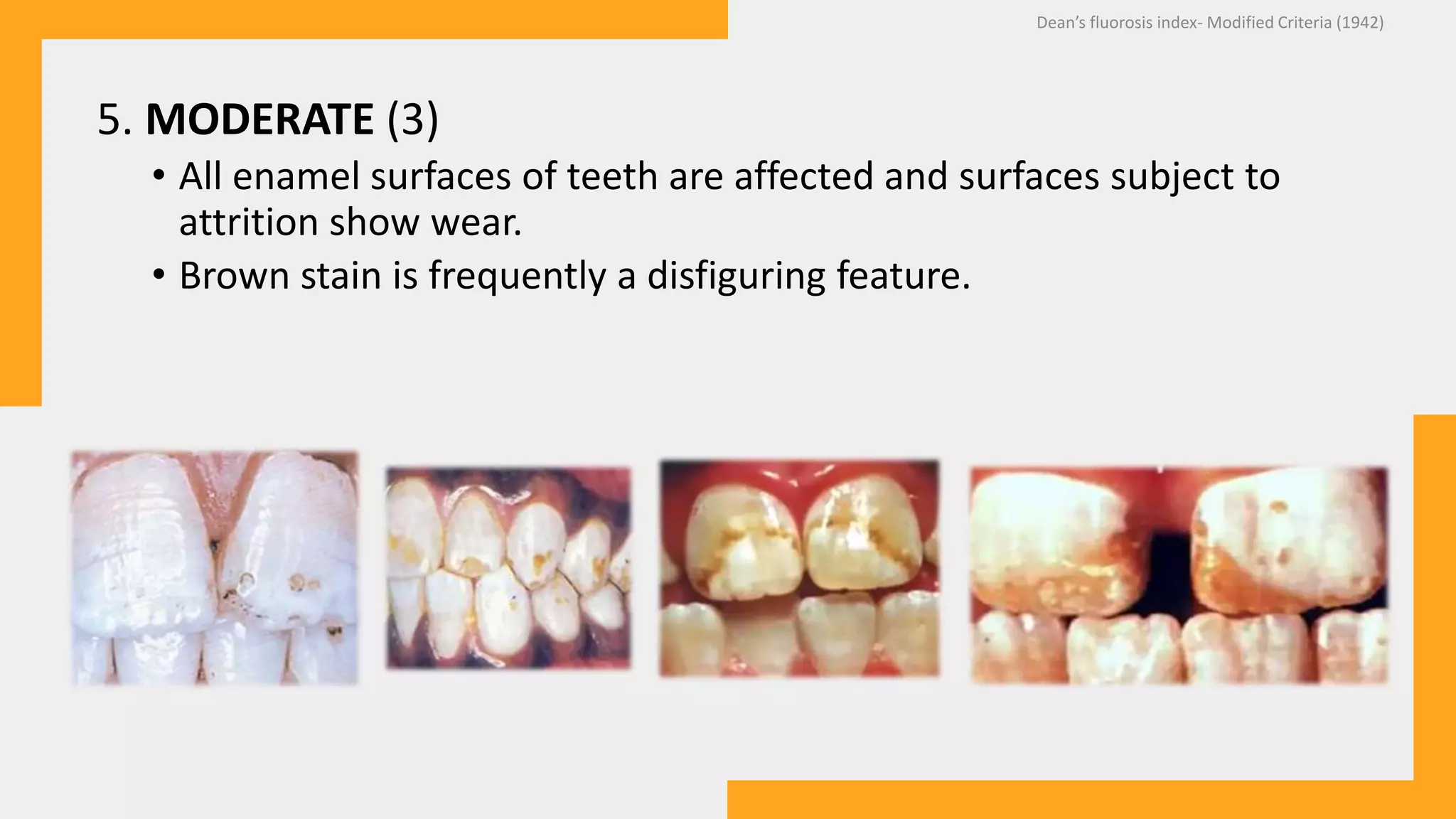 DEAN’S FLUOROSIS INDEX 1943 (PUBLIC HEALTH DENTISTRY) | PPTX