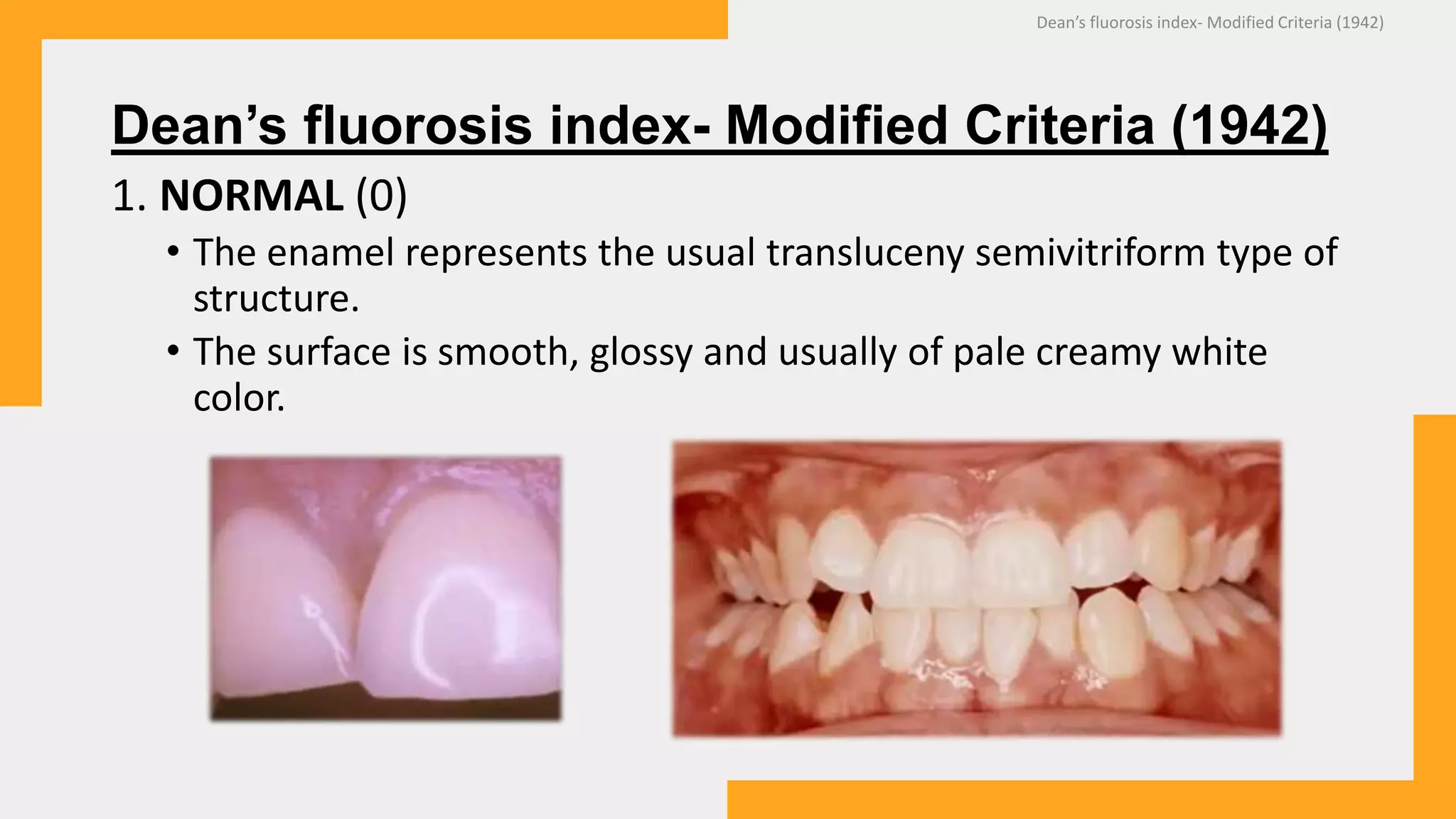 DEAN’S FLUOROSIS INDEX 1943 (PUBLIC HEALTH DENTISTRY) | PPTX