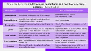 DEAN’S FLUOROSIS INDEX 1943 (PUBLIC HEALTH DENTISTRY) | PPTX