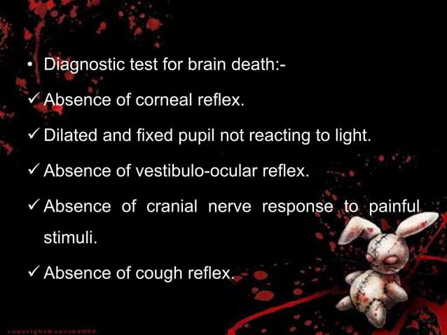 Mode of death | PPTX