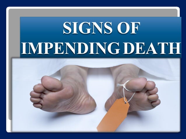 Death and signs of death | PDF