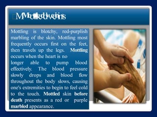 Death and signs of death | PPT