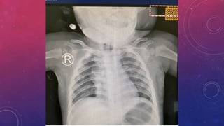 DEATH CASE An Seiya Akira.pptx