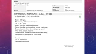 DEATH CASE An Seiya Akira.pptx