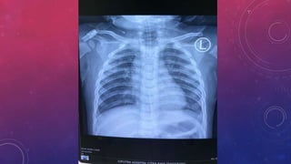 DEATH CASE An Seiya Akira.pptx