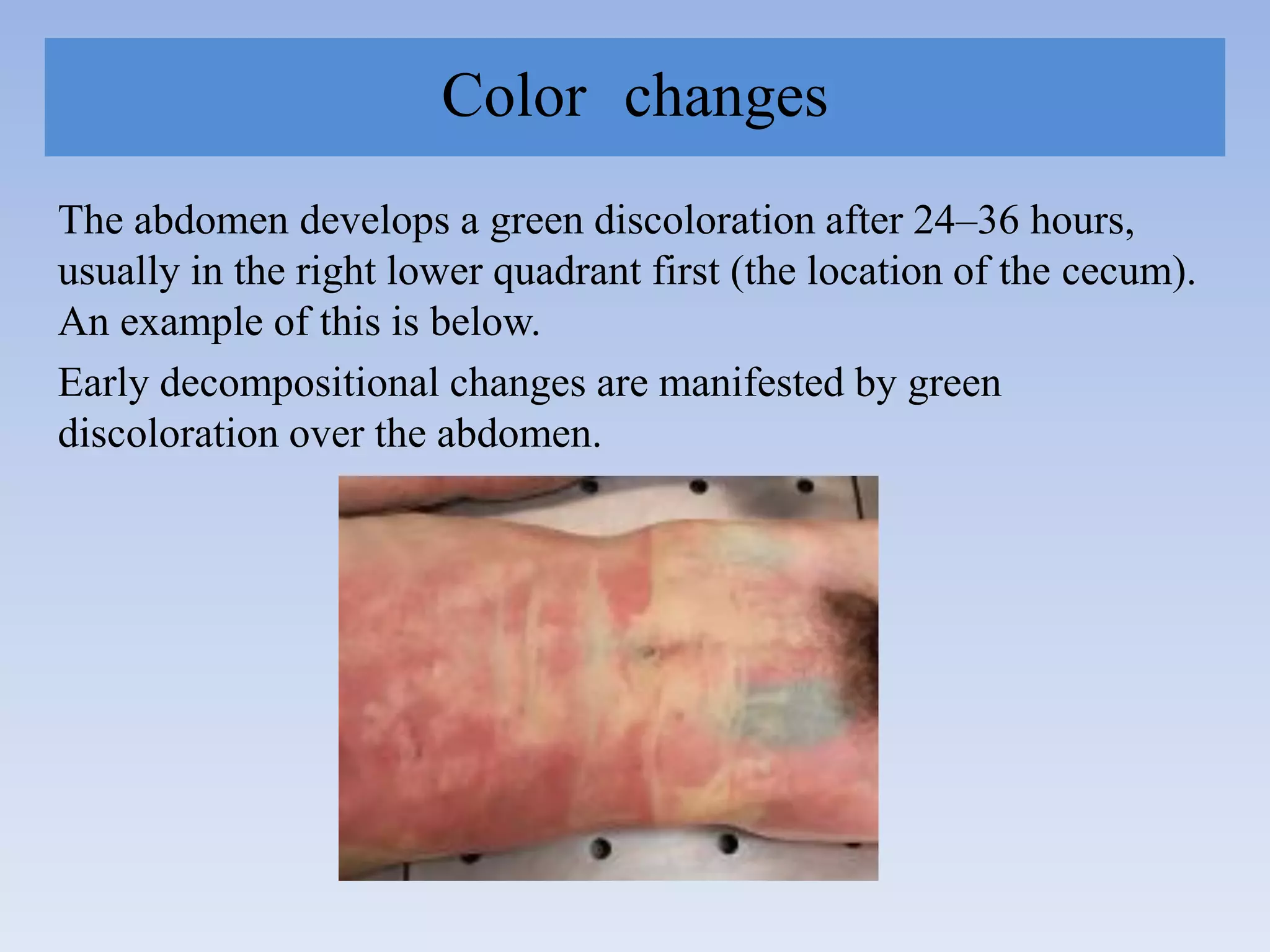 Death & changes after death | PDF