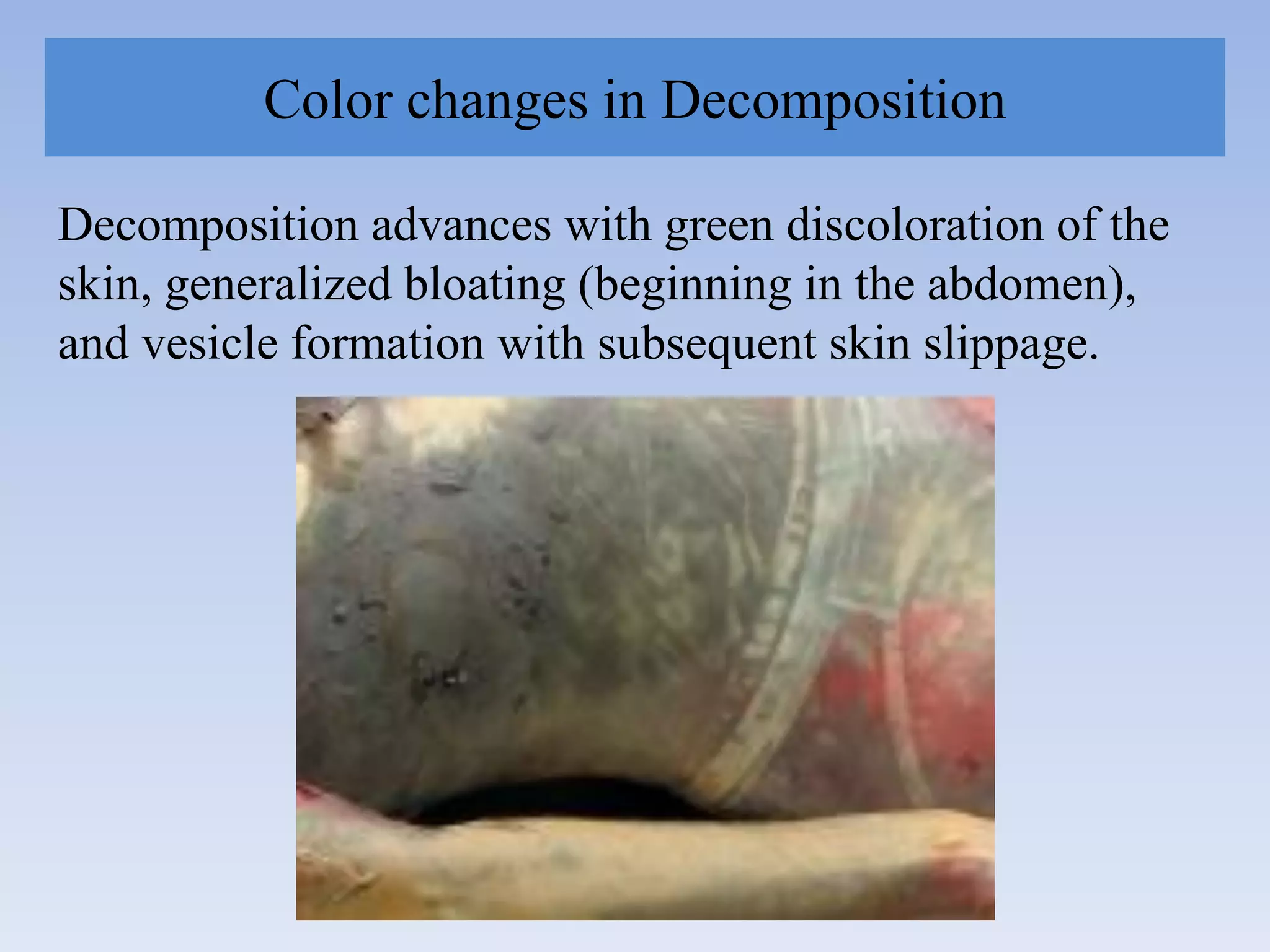 Death & changes after death | PDF