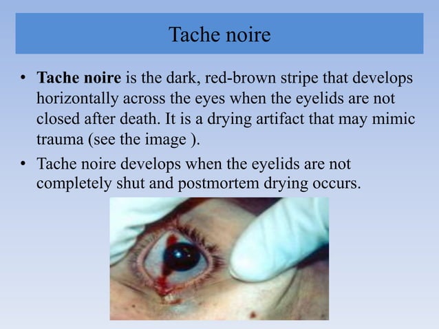 Death & changes after death | PDF | Eye and Vision Conditions ...