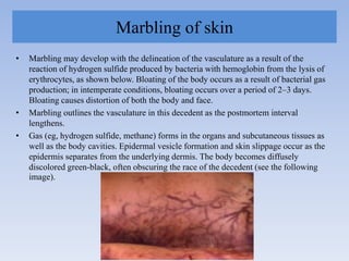 Death & changes after death | PDF | Eye and Vision Conditions ...