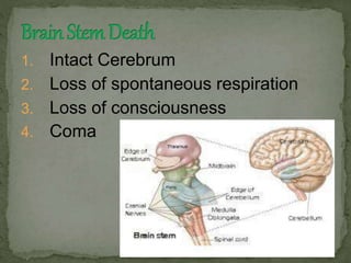 Death & its causes | PPTX