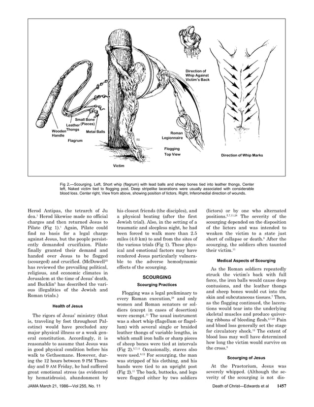 On the physical death of Jesus Christ | PDF