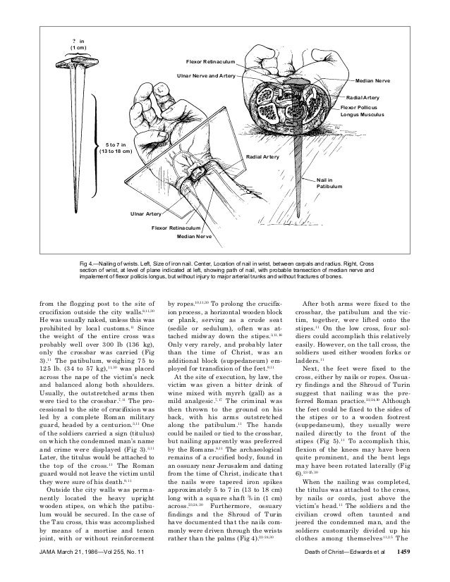 Last Moments Of Emmanuel Sithole Bleeding To Death In List of Saw ...