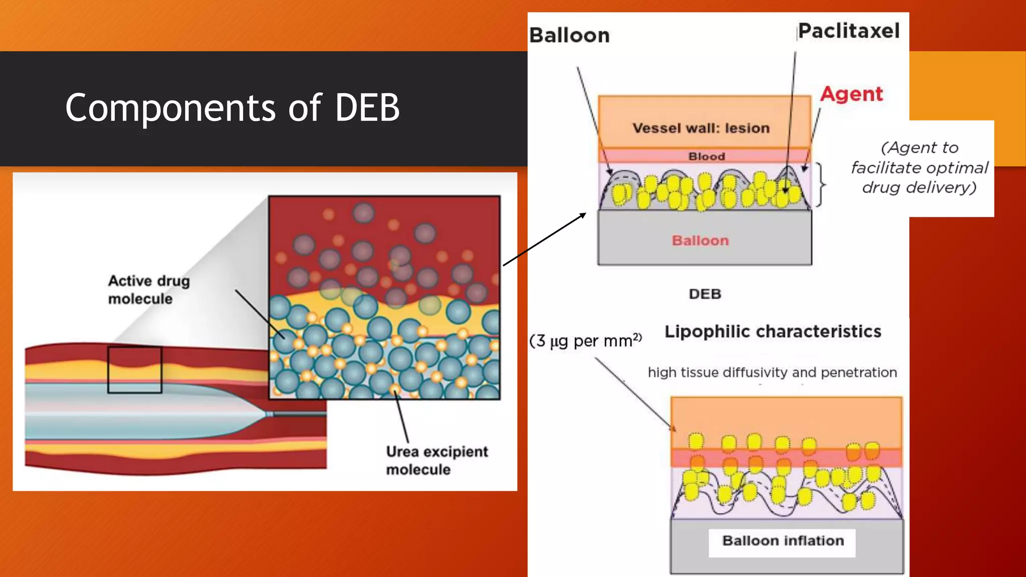 DRUG ELUTING BALLOONS (DCB/DEB) | PPTX
