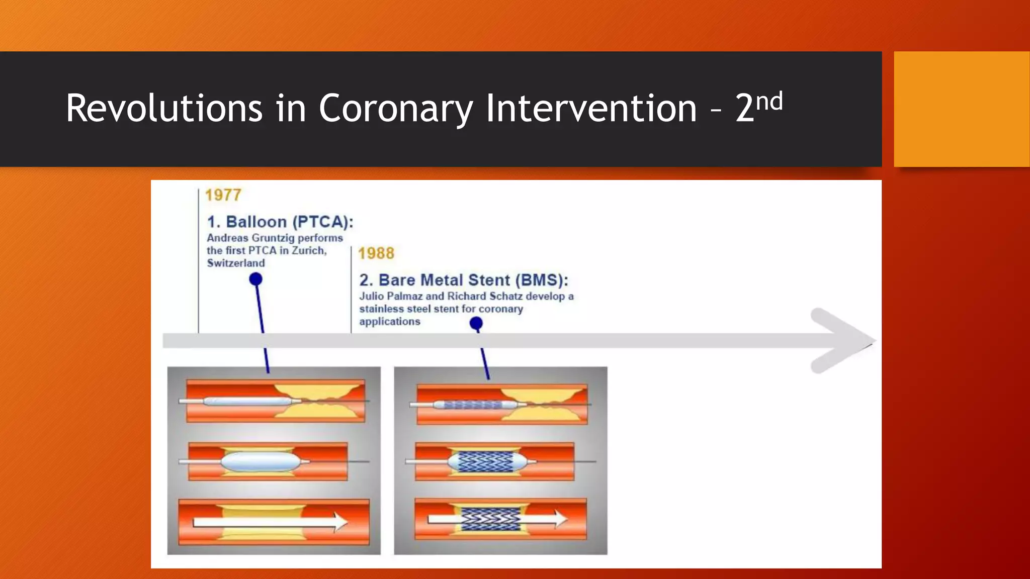 DRUG ELUTING BALLOONS (DCB/DEB) | PPTX