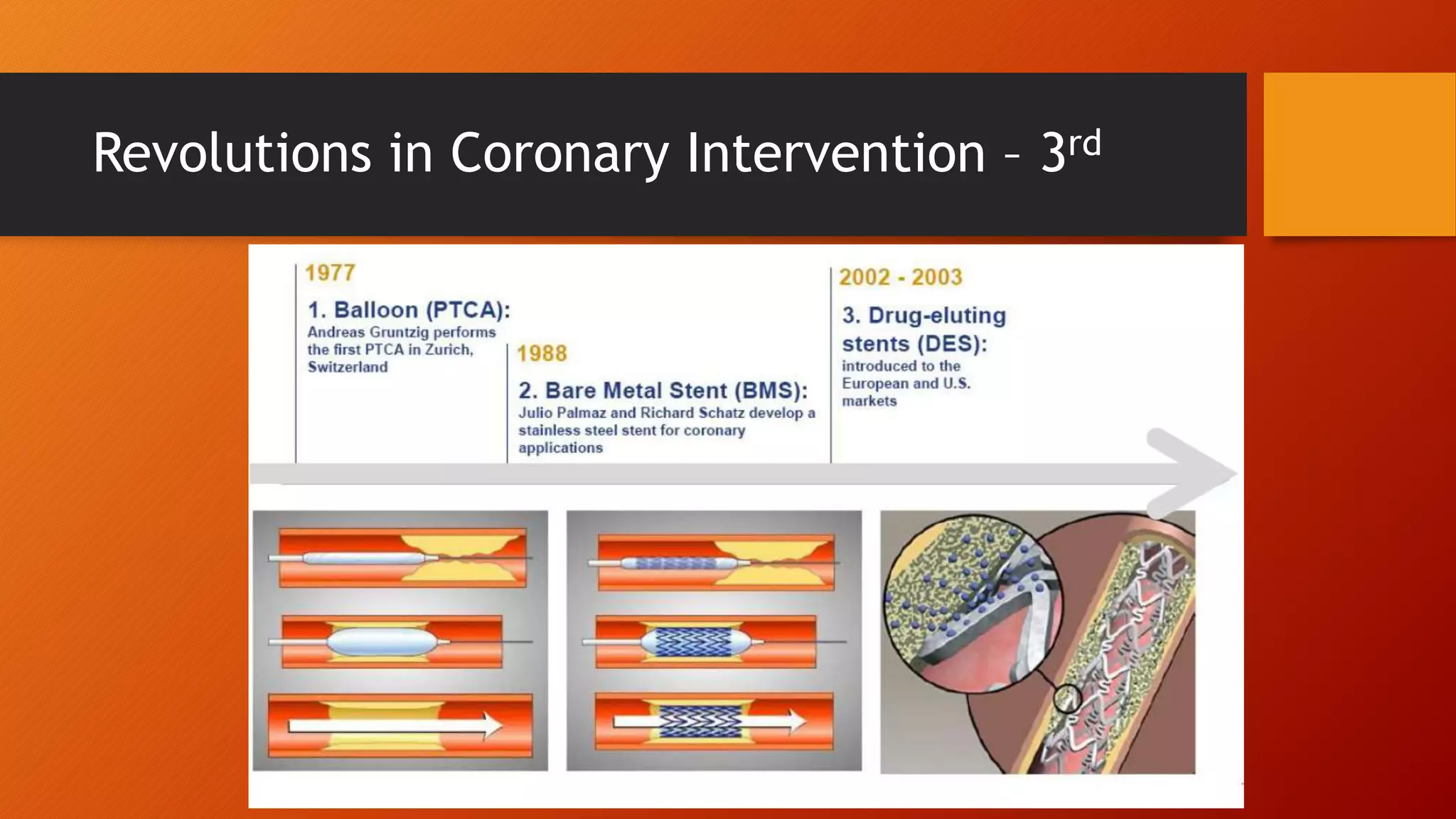 DRUG ELUTING BALLOONS (DCB/DEB) | PPTX