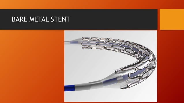 DRUG ELUTING BALLOONS (DCB/DEB) | PPTX