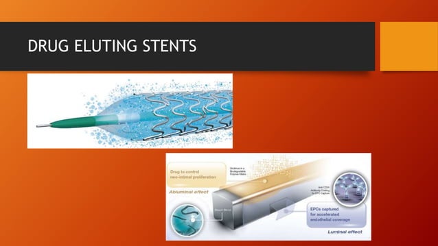 DRUG ELUTING BALLOONS (DCB/DEB) | PPTX