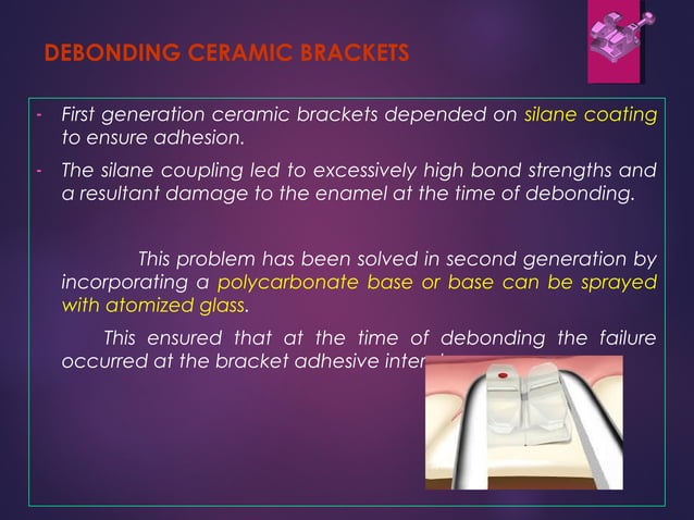 Debonding (2) | PPT | Dental Health | Diseases and Conditions