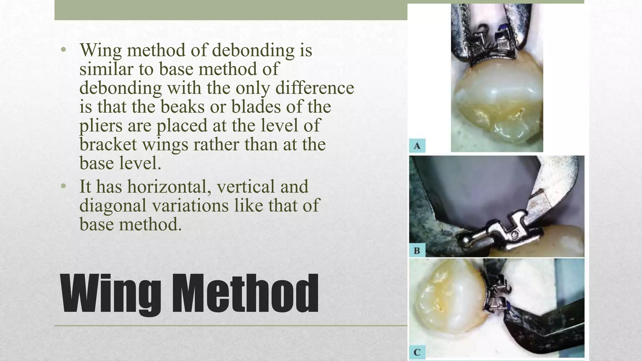 Debonding of orhtodontic brackets | PPTX