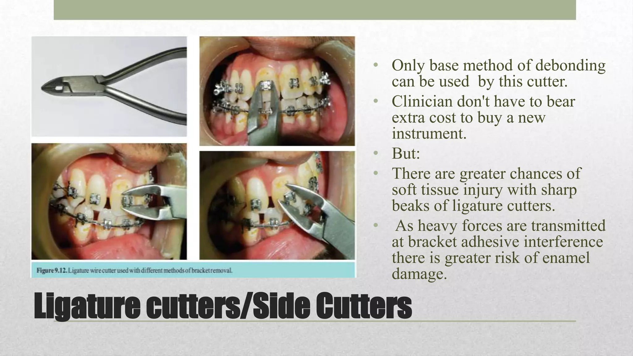 Debonding of orhtodontic brackets | PPTX